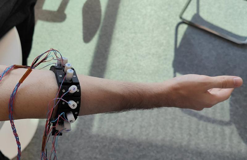 Bidirectional control of prosthetic hands using ultrasonic sensors